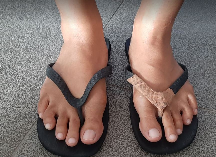 Flip Flop Fix - Legend FM